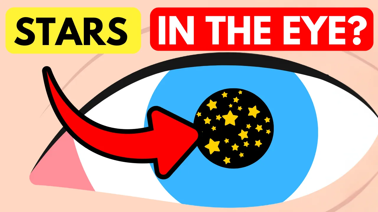 Asteroid Hyalosis: Causes & Effects - Eye Conditions Explained